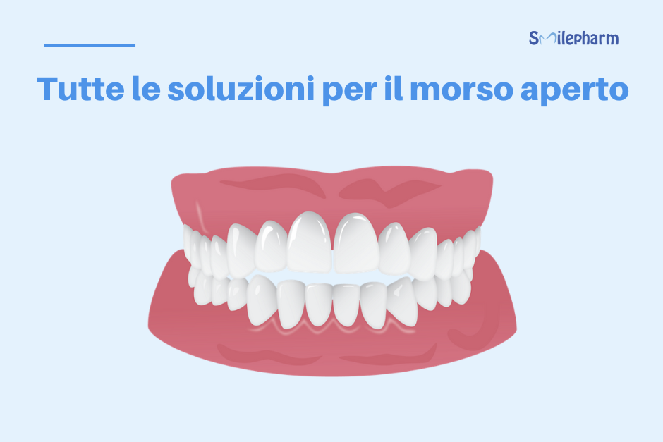 Tutte le soluzioni per il morso aperto - Smilepharm